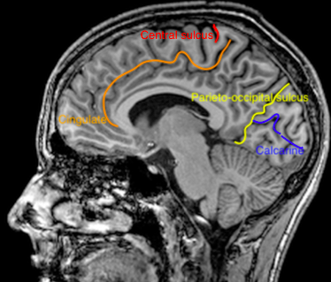 Neocortex – Brain – bit by bit