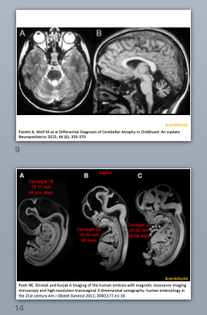 Brain stem and cerebellum – Brain – bit by bit