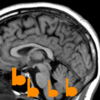Differential diagnosis – Brain – bit by bit