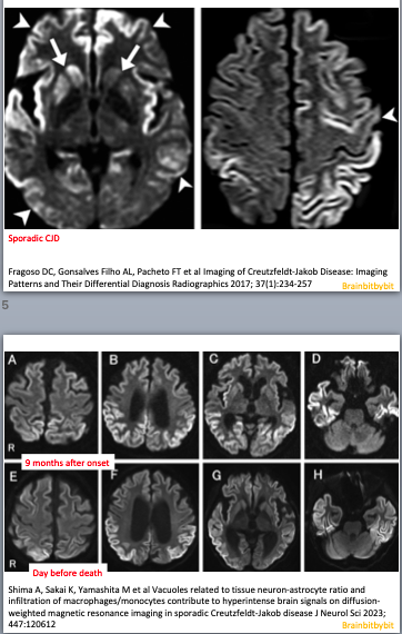 Neocortex – Brain – bit by bit