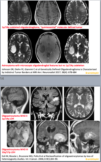 Neocortex – Brain – bit by bit